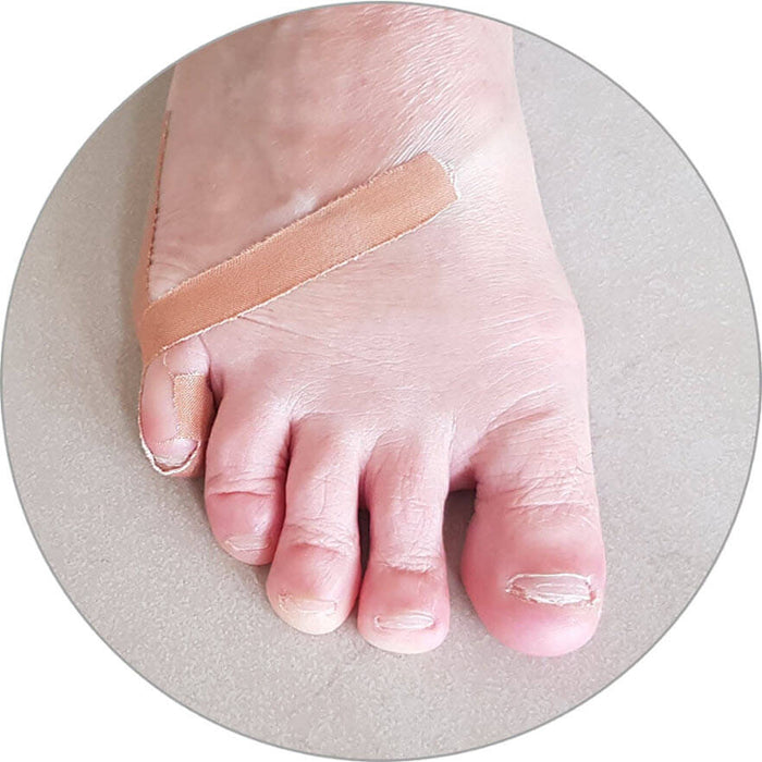 How To Hold A Curly Toe Straight With Strapping Tape